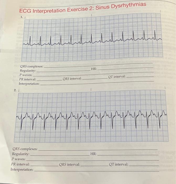 ECG Interpretation Exercise 2: Sinus Dysrhythmias 1. | Chegg.com