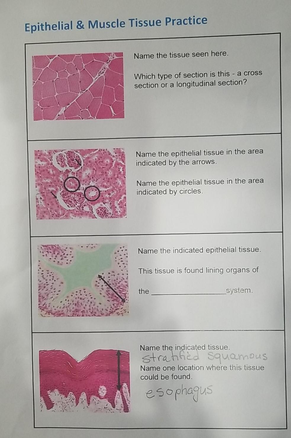 Solved Epithelial & Muscle Tissue Practice Name the tissue | Chegg.com