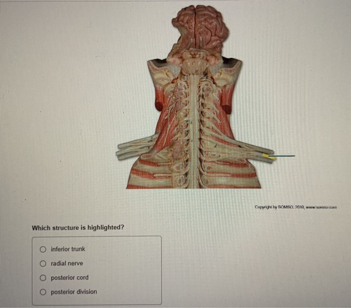Solved Copyright by SOMSO, 2010, www.SENTES COM Which | Chegg.com