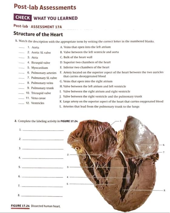 Solved Post-lab Assessments CHECK WHAT YOU LEARNED Post-lab | Chegg.com