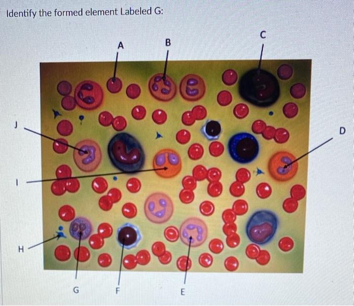 Solved Identify the formed element Labeled G: с C А B J D H | Chegg.com