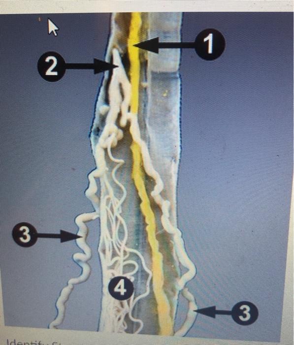 Solved Identify Structure: | Chegg.com Solved Identify Structure: | Chegg.com