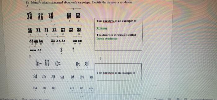 Solved 8) Identify what is abnormal about each karyotype | Chegg.com