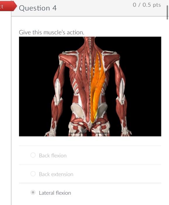 Give this muscle's action. Back flexion Back | Chegg.com