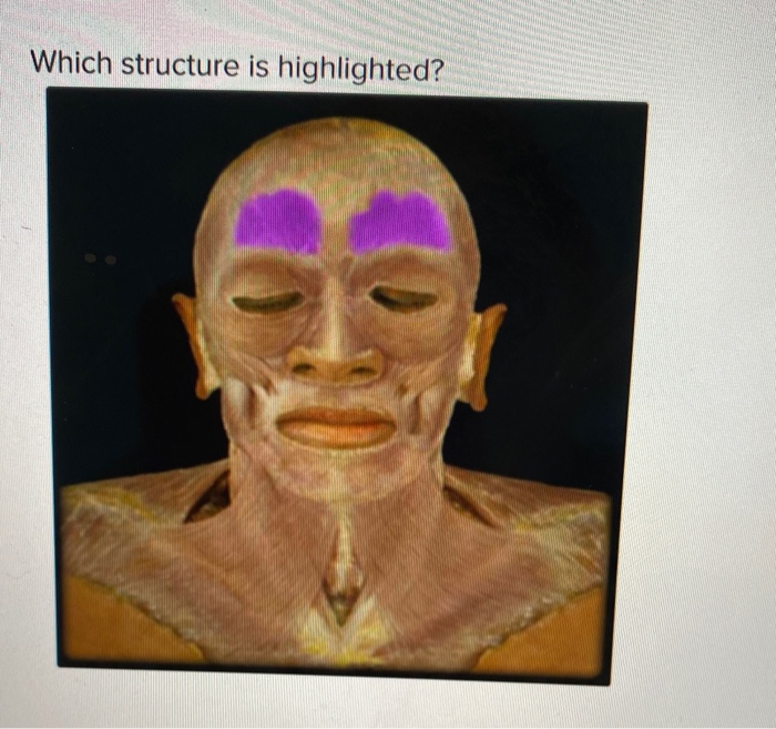Solved Which structure is highlighted? Which structure is | Chegg.com