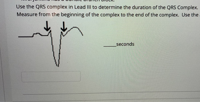 Please answer the following questions:1) Use the QRS | Chegg.com