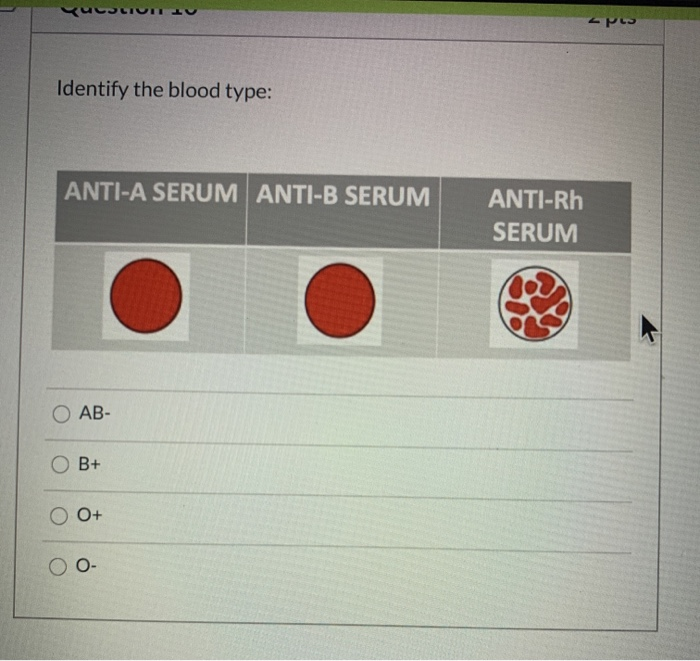 Solved - Identify the blood type: ANTI-A SERUM ANTI-B SERUM | Chegg.com