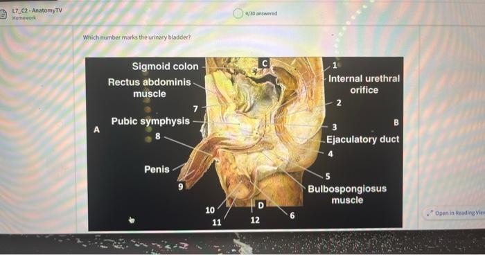 Solved Which nomber labeis the urethra? Click ALL that | Chegg.com