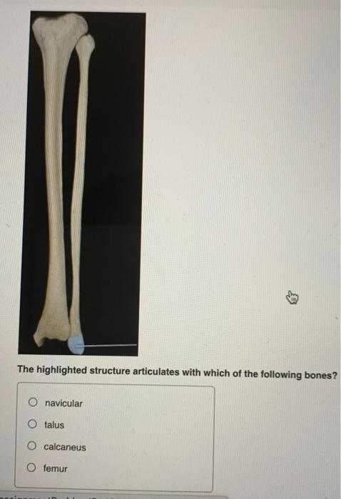 Solved Which structure is highlighted? O acromial end O | Chegg.com