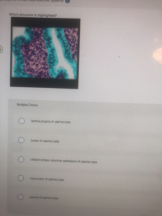Solved PULVE Systems Which structure is highlighted? | Chegg.com