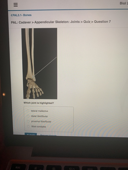 Solved: Biol Appendicular Skeleton: Joints > Quiz > Questi... | Chegg.com