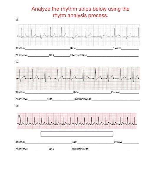 Solved Analyze the rhythm strips below using the the rhythm | Chegg.com