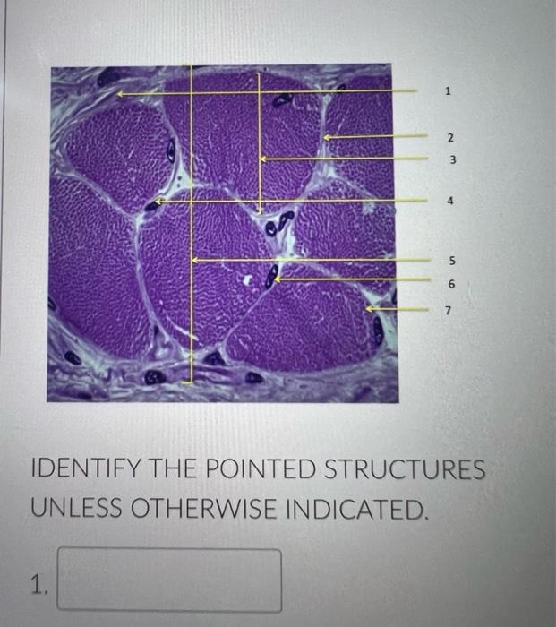 Solved 2 w N 4 5 6 7 IDENTIFY THE POINTED STRUCTURES UNLESS | Chegg.com