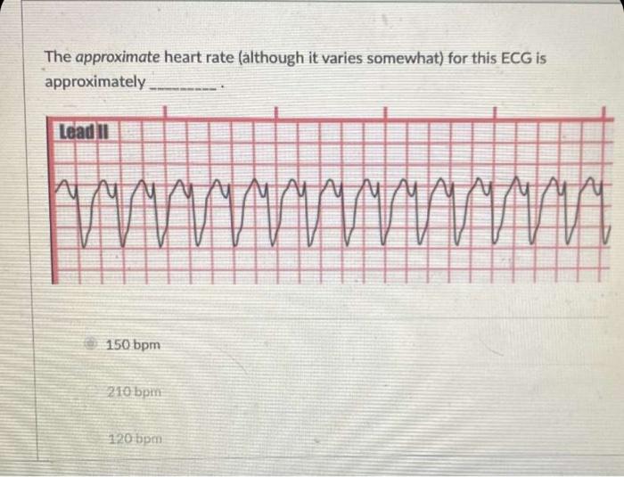 Solved The approximate heart rate (although it varies | Chegg.com