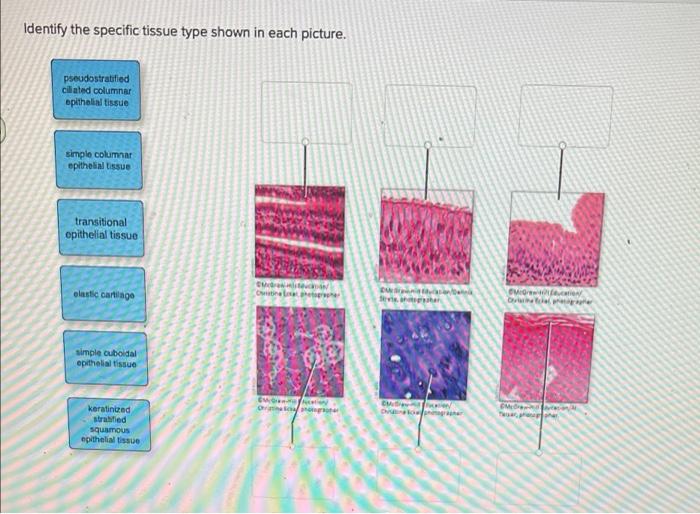 Solved Identify the specific tissue type shown in each | Chegg.com