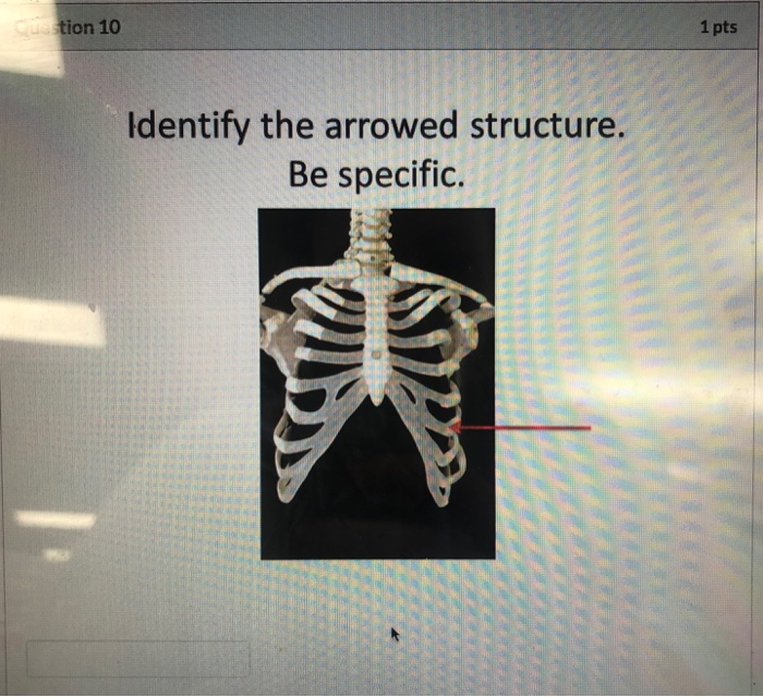 Solved uestion 1 1 pts Identify the arrowed structure. Be | Chegg.com Solved uestion 1 1 pts Identify the arrowed structure. Be | Chegg.com