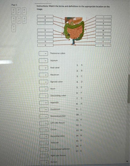 Solved Instructions: Match the terms and definitions to the | Chegg.com