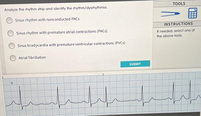 Premature Atrial Contraction Strip