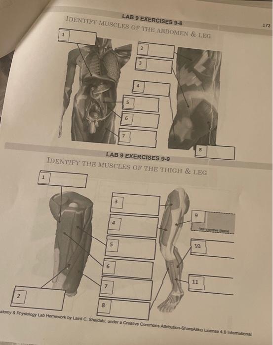 Solved LAB 9 EXERCISES 9−8 IUENTIFY THE MUSCLES OF THE THIC | Chegg.com
