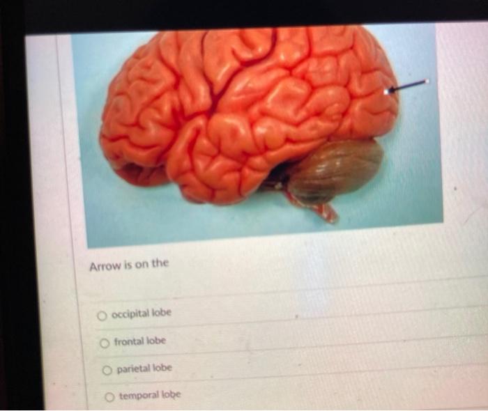 Solved RELALIA Arrow is pointing to bulbous corpuscle Merkel | Chegg.com