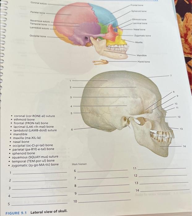 Solved Befontal taemon Bquartious wintire Tomporal bonen | Chegg.com