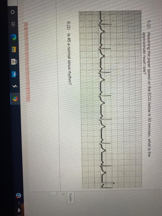 Solved 5.(2) Assuming the paper speed on the ECG below is 50 | Chegg.com