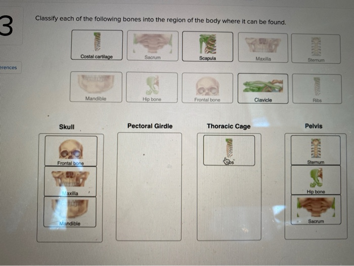 Solved Classify each of the following bones into the region | Chegg.com