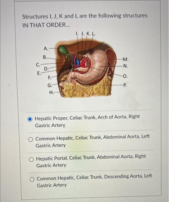 Solved Structures A, B, C, and D are the following | Chegg.com