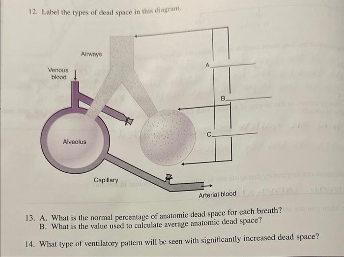 Solved 12. Label the types of dead space in this diagram. | Chegg.com