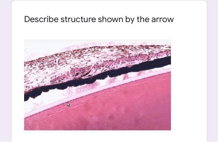 Describe structure shown by the arrow Your answer | Chegg.com