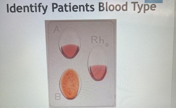 Solved Identify Patients Blood Type Rho | Chegg.com