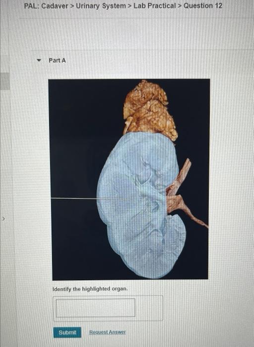 Solved PAL: Cadaver > Urinary System > Lab Practical > | Chegg.com