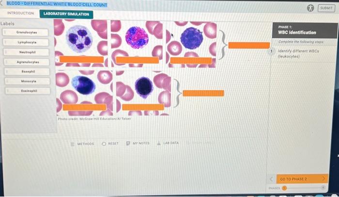 Solved SUBMIT BLOOD DIFFERENTIAL WHITE BLOOD CELL COUNT | Chegg.com