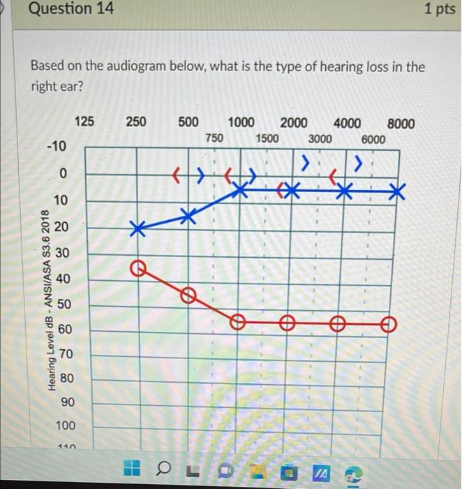Solved Question 14 1 pts Based on the audiogram below, what | Chegg.com