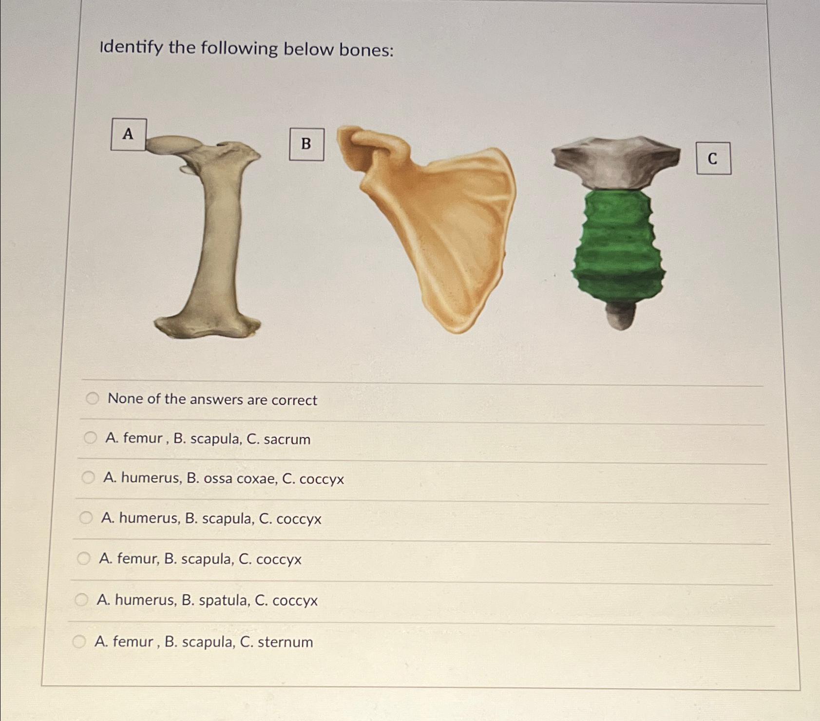Solved Identify the following below bones:ABNone of the | Chegg.com