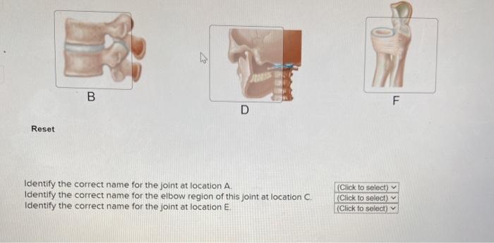 Solved Drag each label at the top to the joint to which it | Chegg.com