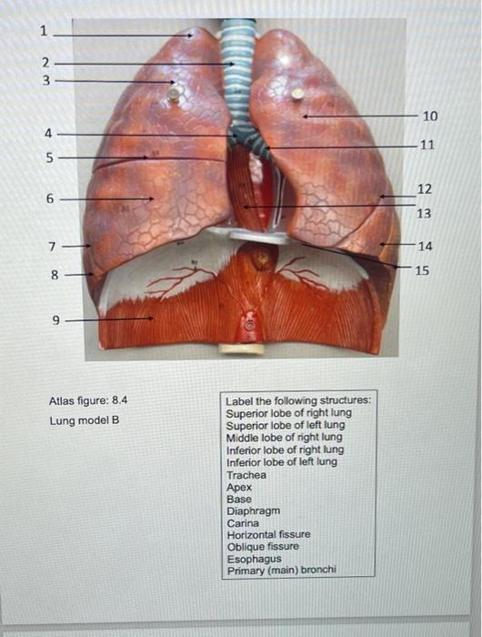 Solved 1 2 8 00 Trachea التا 3 4 9 5 5 10 Superior lobe of | Chegg.com
