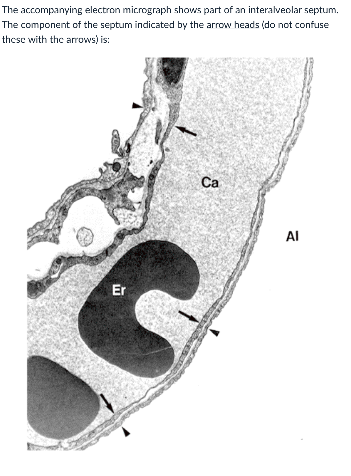 Solved The accompanying electron micrograph shows part of an | Chegg.com