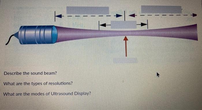 Solved Describe the sound beam? What are the types of | Chegg.com