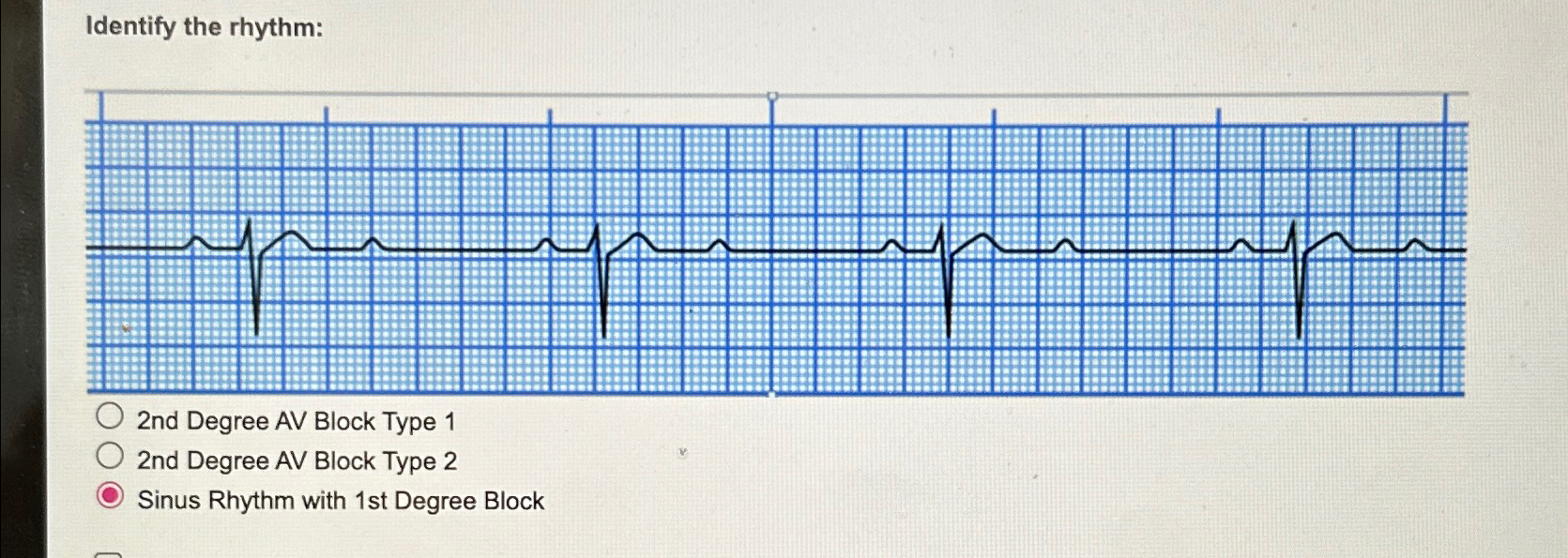 Solved Identify the rhythm:2nd Degree AV Block Type 12nd | Chegg.com