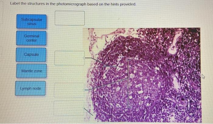 Solved Label the structures in the photomicrograph based on | Chegg.com