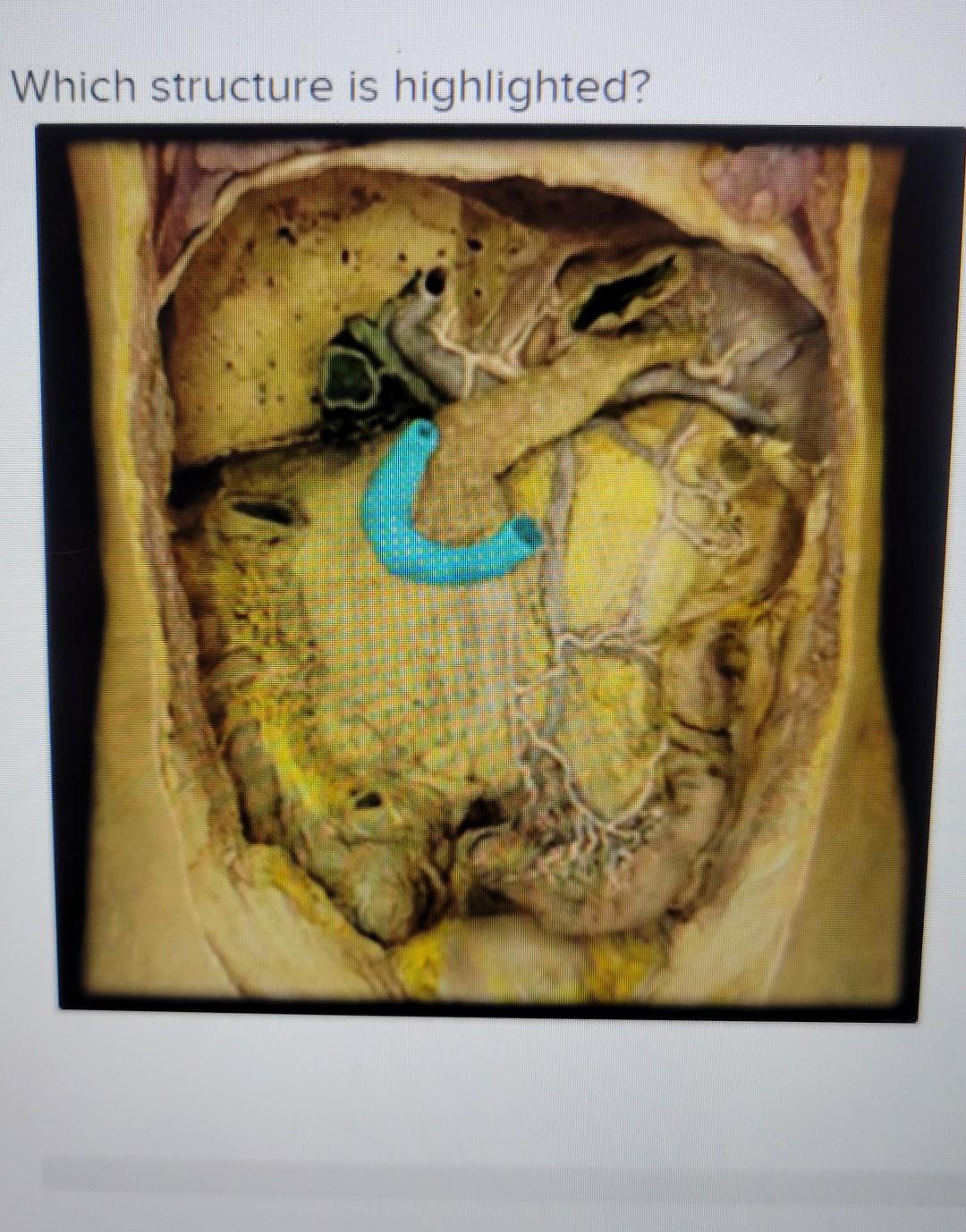 Solved ileum duodenum jejunum cecum | Chegg.com
