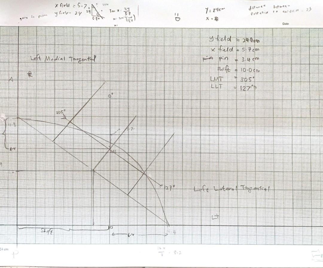 what are the steps of manual drawing a radiotherapy | Chegg.com