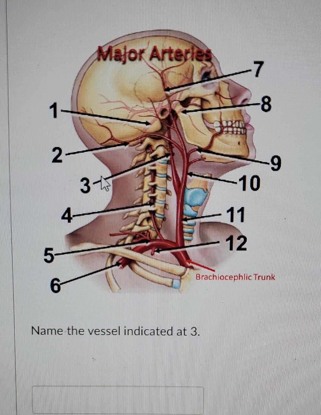 Solved Name the vessel indicated at 3 . Name the vessel | Chegg.com