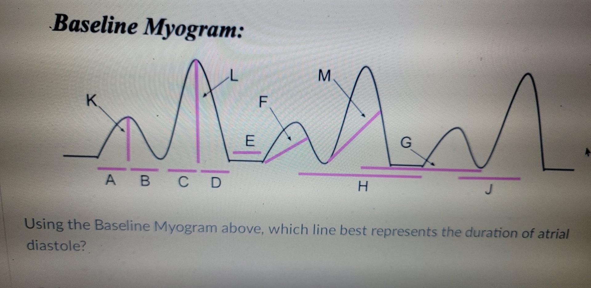 Solved Baseline Myogram: K Man A B C D J Using the Baseline | Chegg.com