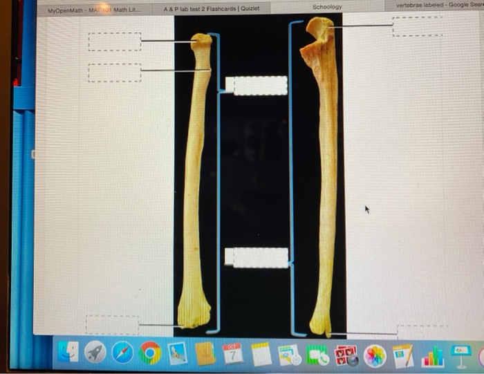 Solved label the parts of the bone with lines pointing to | Chegg.com