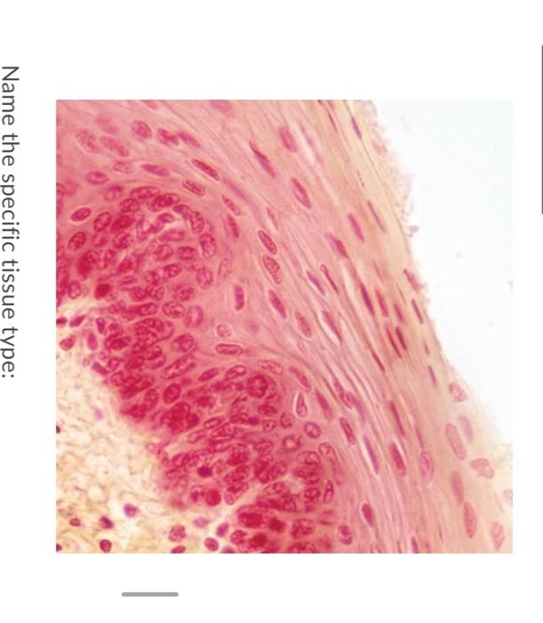+ 1. General tissue type: EPITHELIAL Specific tissue | Chegg.com