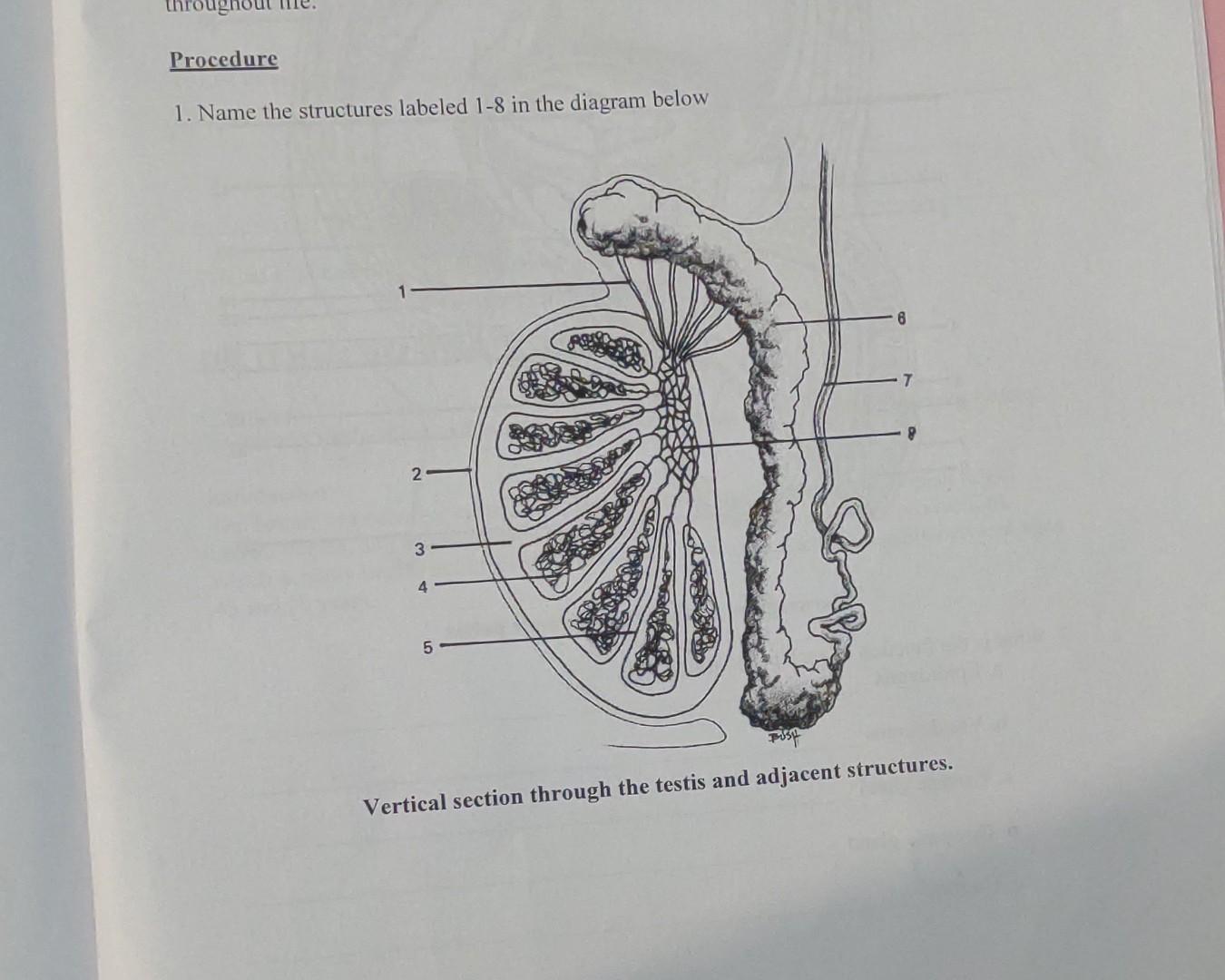 Solved Procedure 1. Name the structures labeled 1−8 in the | Chegg.com