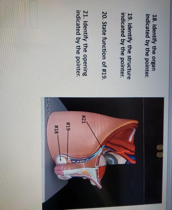 Solved 18. Identify the organ indicated by the pointer. 19. | Chegg.com