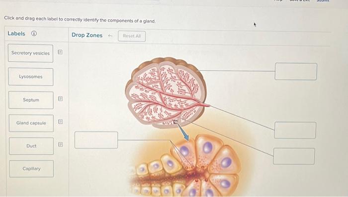 Click and drag each label to correctly identify the | Chegg.com